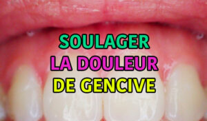 Soulager la douleur de gencive : des astuces simples et rapides